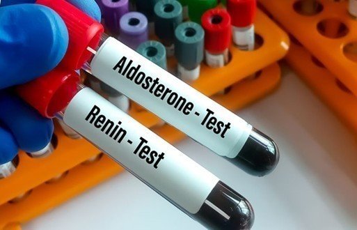 Low Renin Levels, High Blood Pressure and Adrenal Tumors: 6 Things ...