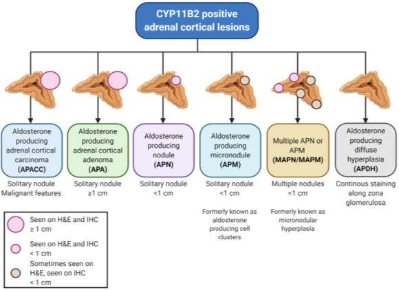 4 Things to Know about Hyperaldosteronism and Hypertension
